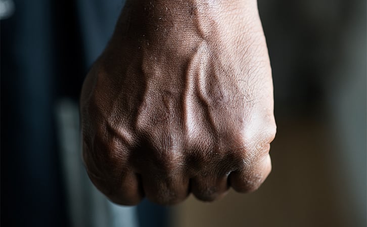 What to Expect When Recovering from Frontal Lobe Damage