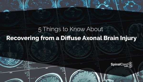 5 Things to Know About Recovering from a Diffuse Axonal Brain Injury