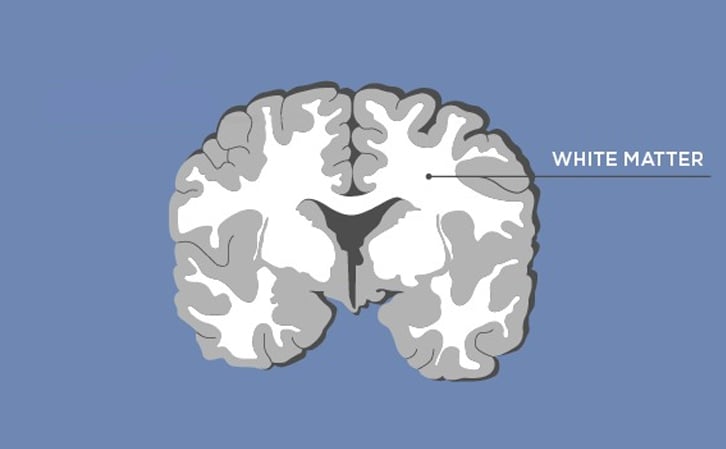Grey Matter vs White Matter in the Brain