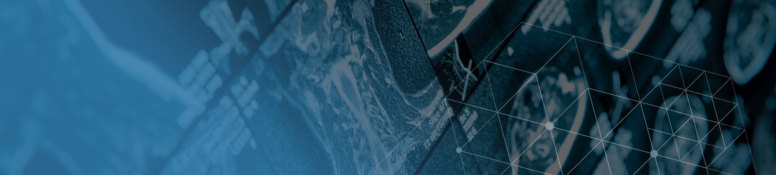 Focal Brain Injury | SpinalCord.com