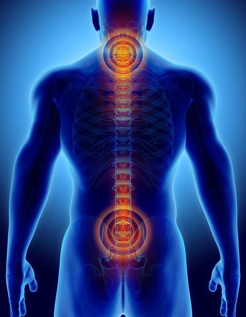 Paraplegia: Meaning, Causes, Symptoms, Treatment & Outlook