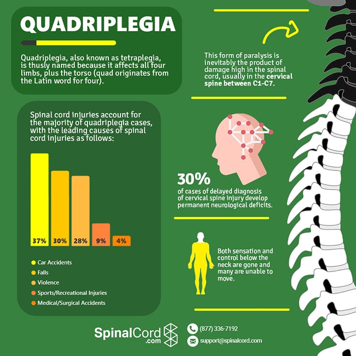 Quadriplegia & Tetraplegia: Definition, Causes, Symptoms, and Treatment