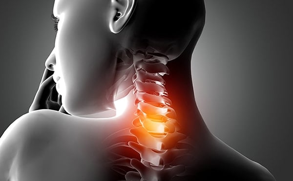 C6, C7, & C8 Spinal Injuries- Know This About Cervical Spine Fractures