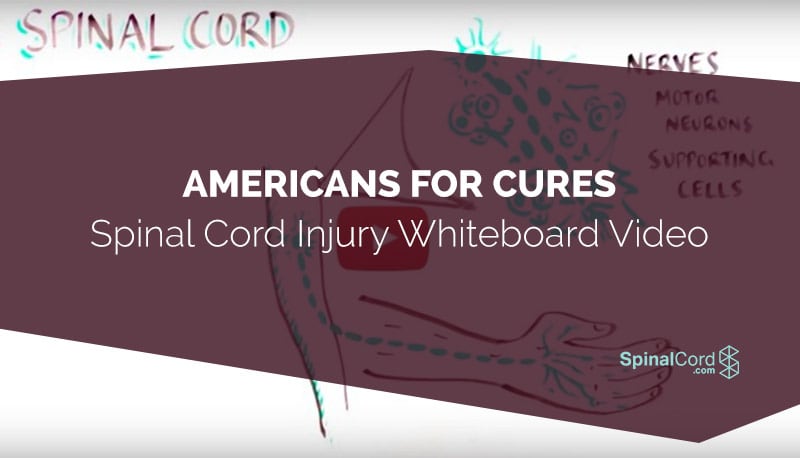 Spinal Cord Injury Whiteboard Video from Americans for Cures